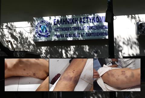 Άγιος Παντελεήμονας: Ερωτηματικά για τον θάνατο του μετανάστη στο ΑΤ ...