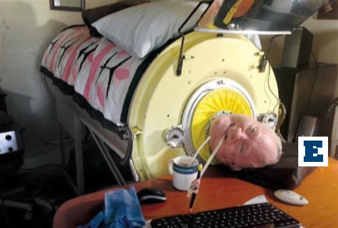 Paul Alexander: Πέθανε ο άνθρωπος που έζησε για πάνω από 70 χρόνια σε ...